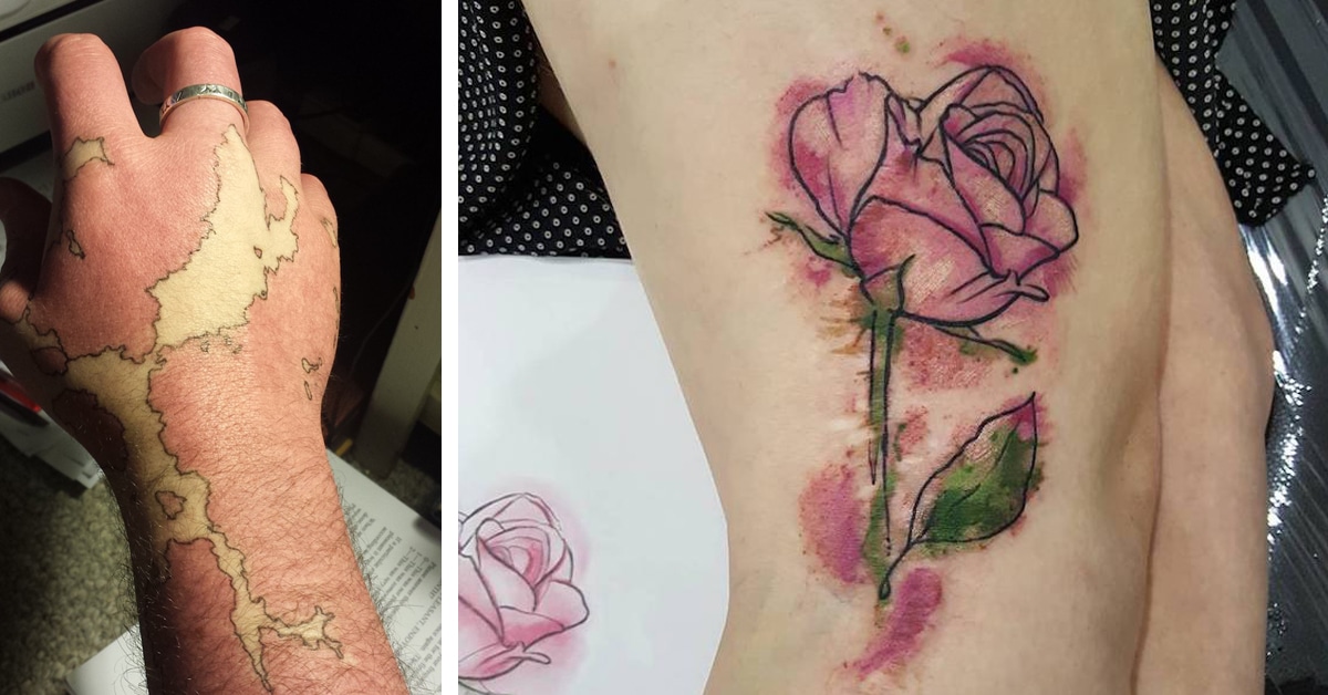 20+ Creative Tattoos that Transform Birthmarks into Clever Works of Art ...