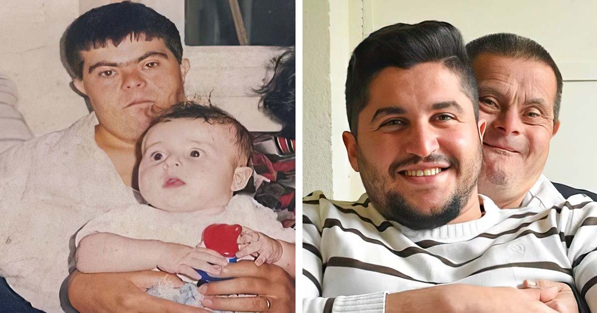 Dad With Down Syndrome Raises a Dentist Son and Shows the Power of Love ...